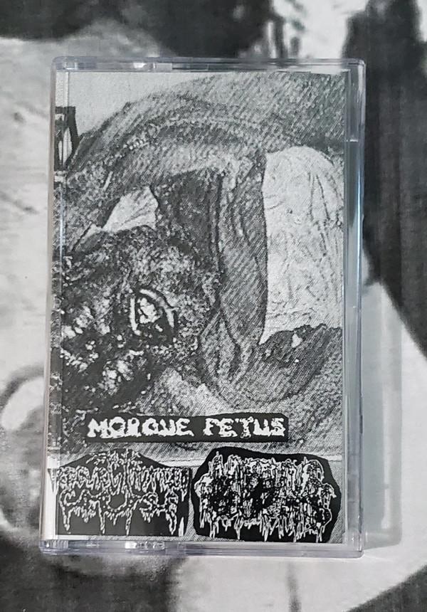 3 Ways Of Nauseated Corpse Rotting In The Morgue - Regurgitated Corpse ...
