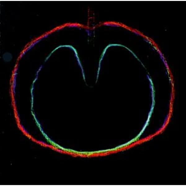 XTC WASP STAR (APPLE VENUS VOL. 2) Vinyl Record