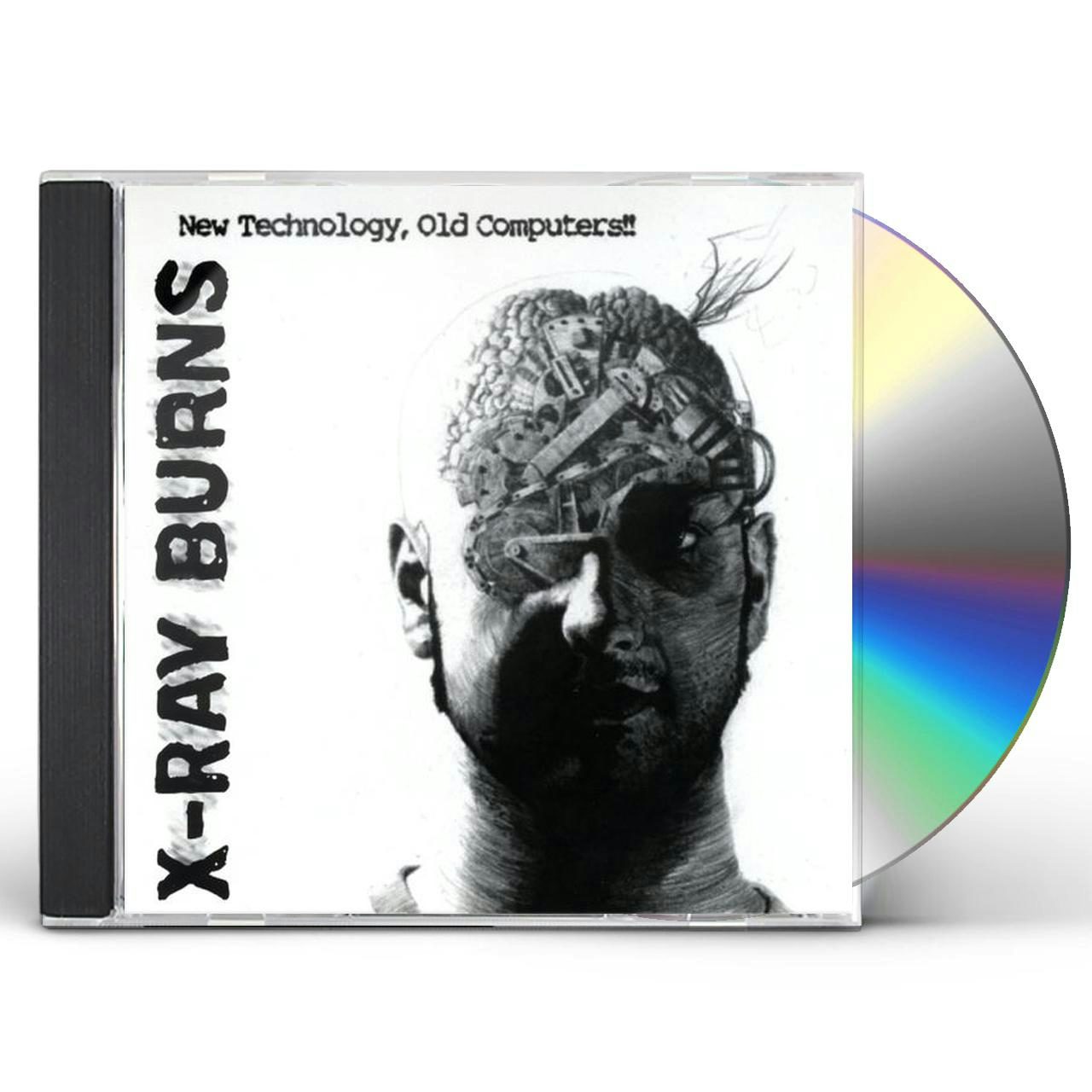 X-Ray Burns NEW TECHNOLOGY OLD COMPUTERS CD