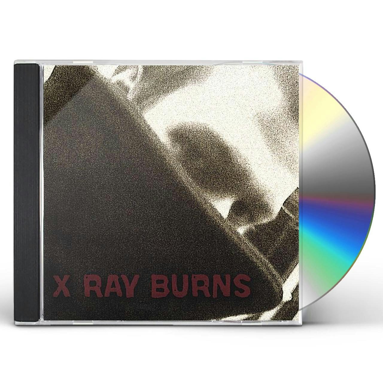 X-Ray Burns RUPERTS REVENGE CD