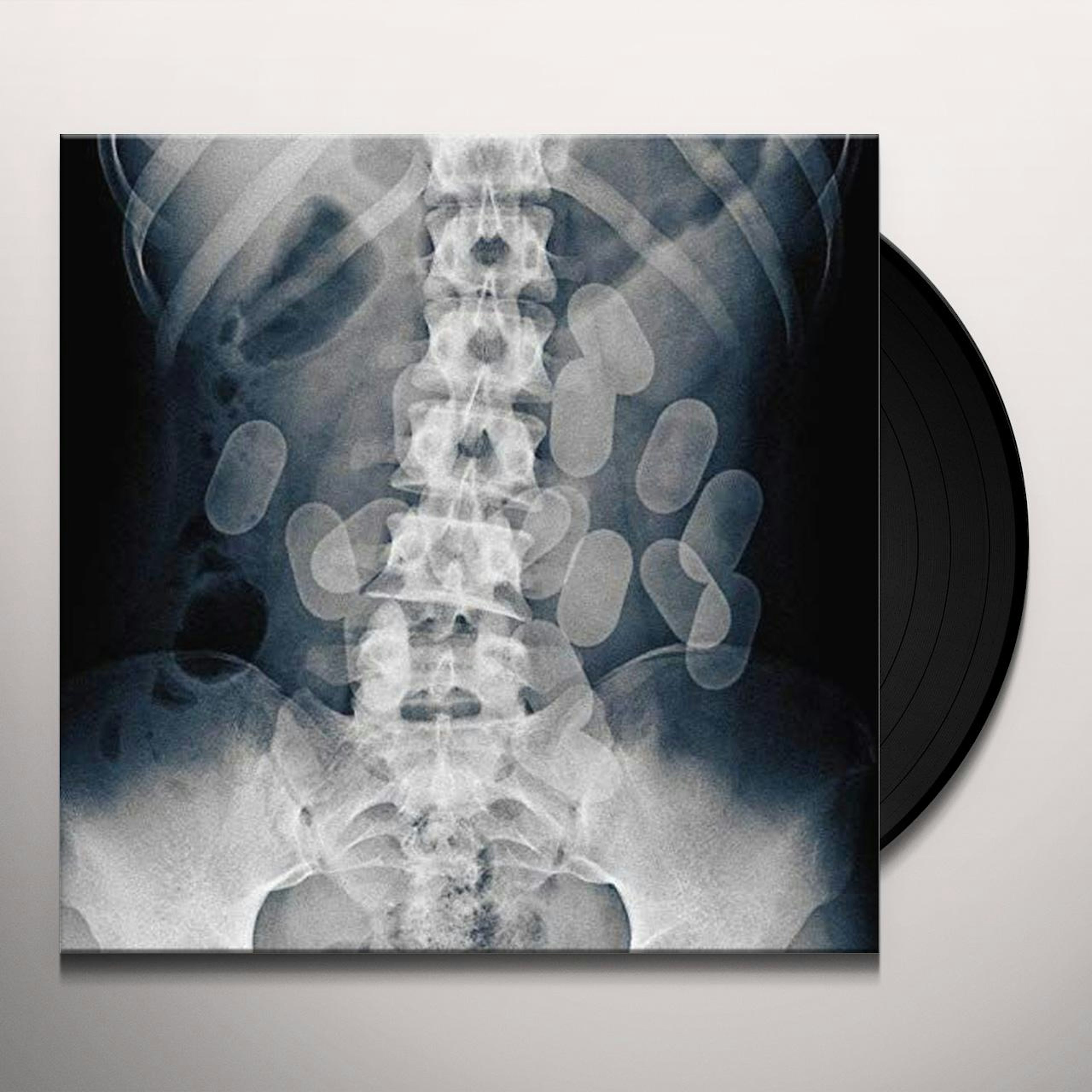 Night Skinny MATTONI X-RAY Vinyl Record
